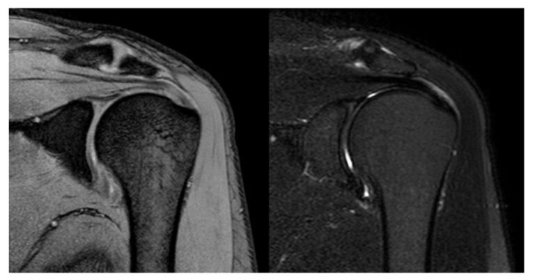 第18回 MR専門技術者認定試験 解答と解説ラジブログ